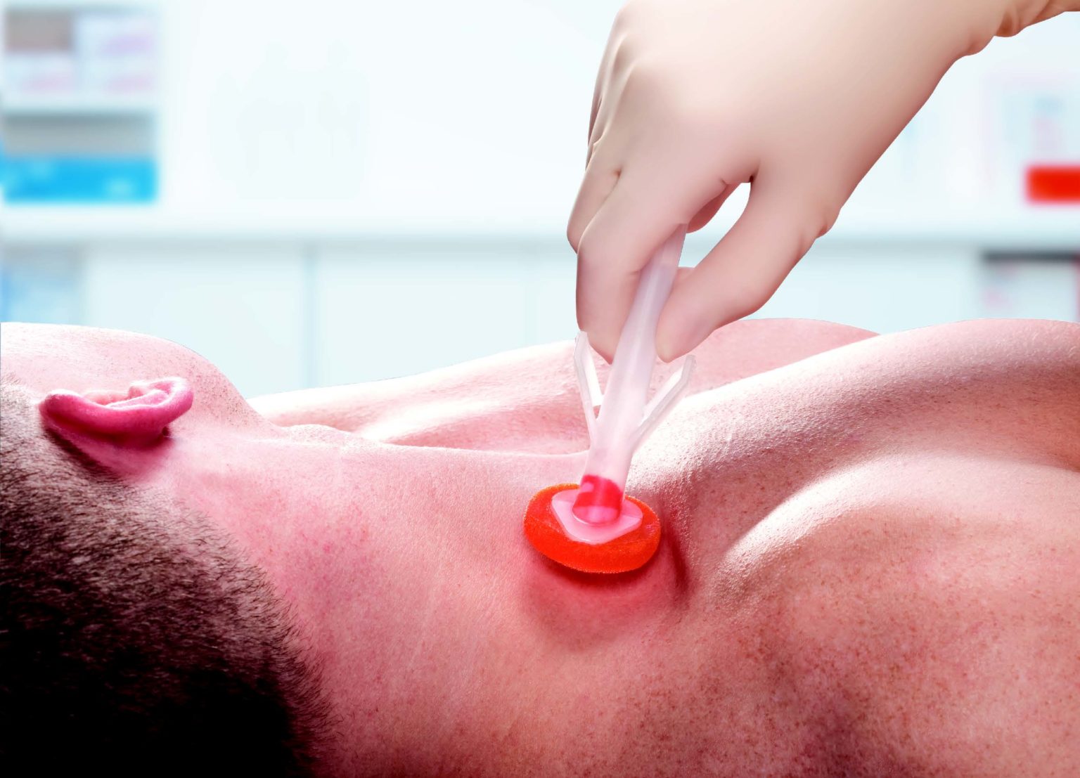 ChloraPrep™ Skin Preparation – Iskus Health