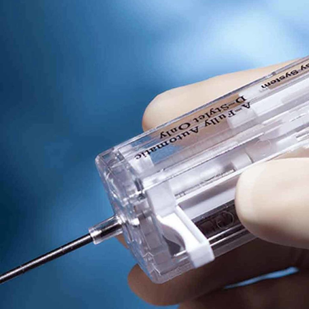 Achieve™ Biopsy Needles – Iskus Health
